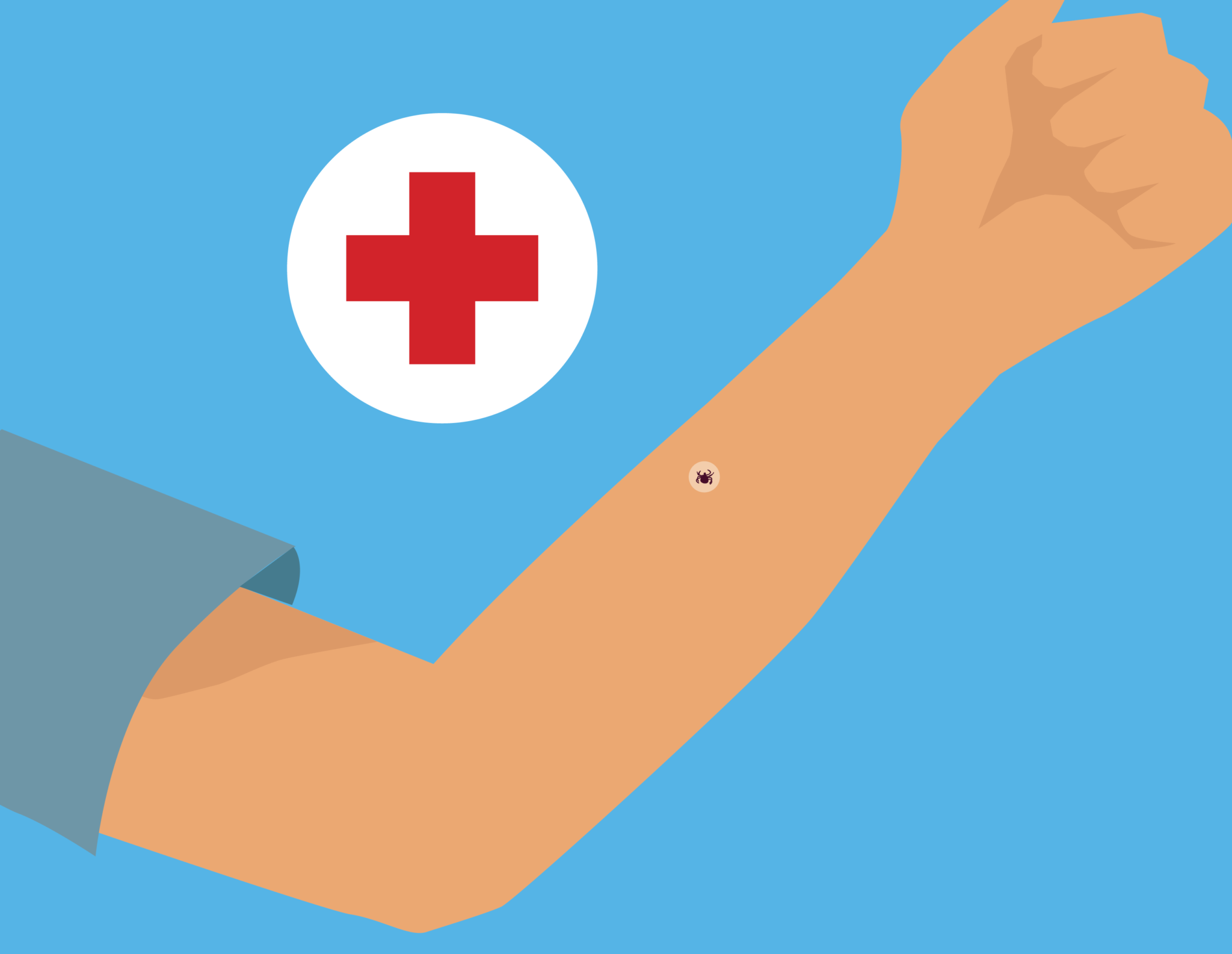 Insect and tick allergy - Young Adults